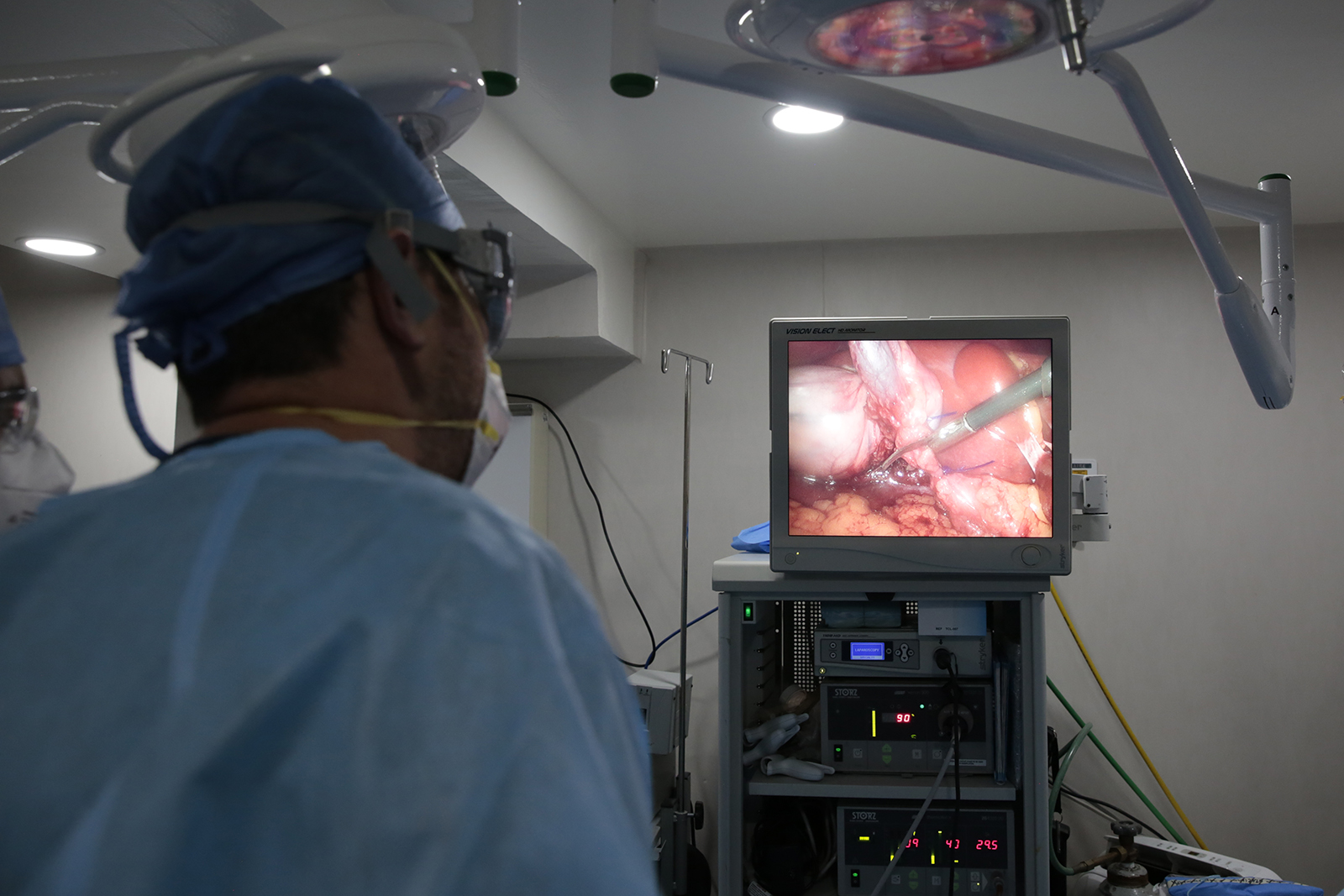 Endoscopia Gastrointestinal - Gastroenterólogo CDMX